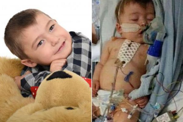 Boy with second most common genetic disorder 'almost died 3 times in 2 ...
