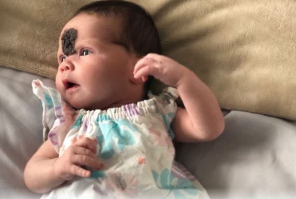 Desperate parents will have to pay £11k after baby girl refused facial ...