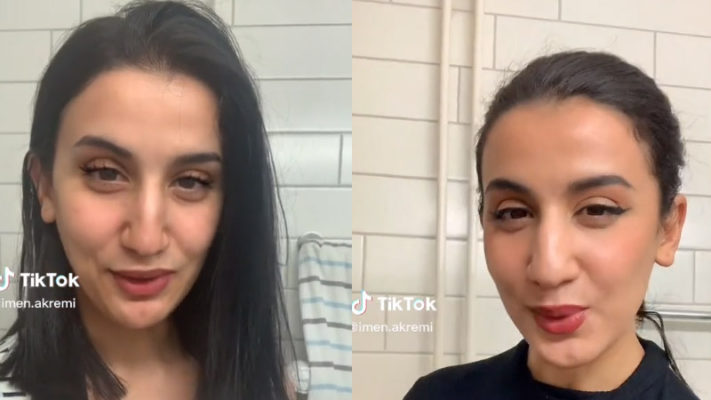 Woman explains wonderful results of not washing her face for few months